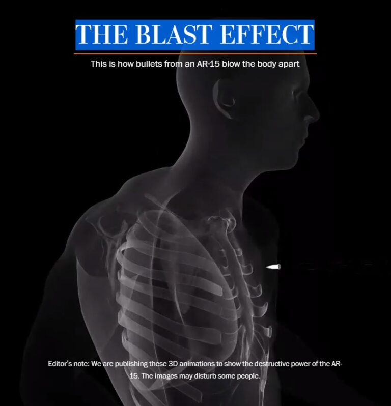 "The Blast Effect", More than just horrific damage to victims - Guyana ...